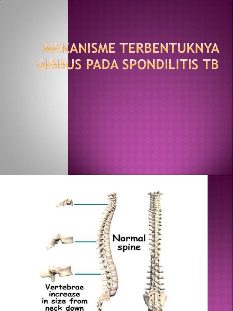 Gibbus | PDF