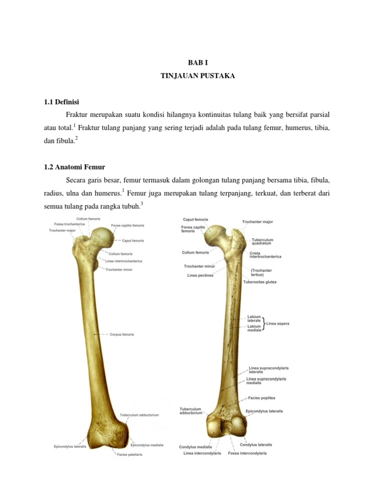 fraktur femur