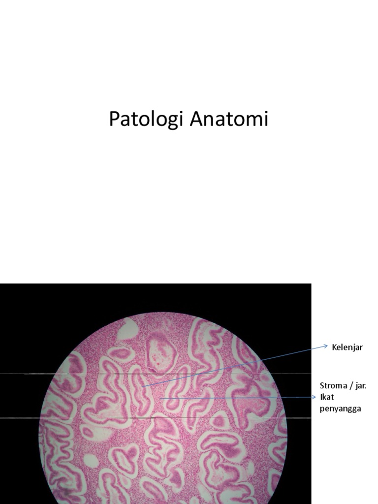 Patologi Anatomi Kelenjar dan Jaringan | PDF | Memasak, Makanan ...