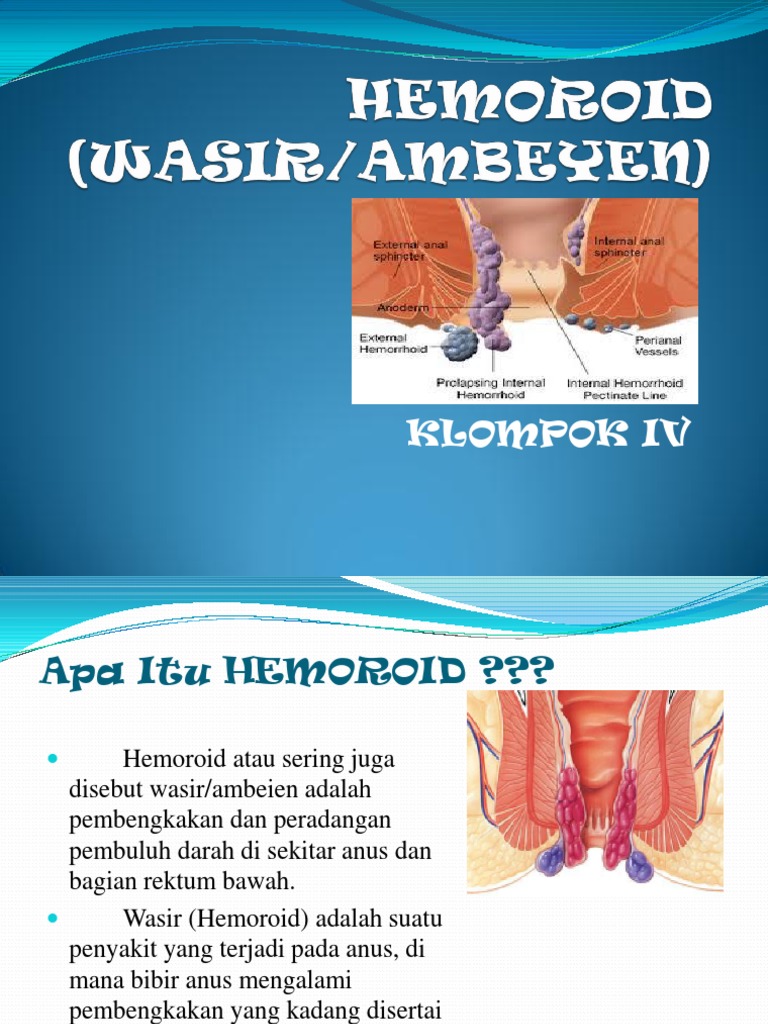 Penjelasan Lengkap Tentang Hemoroid | PDF