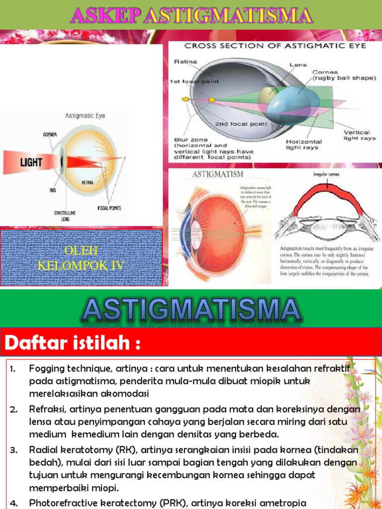 Panduan Lengkap Astigmatisma dan Penanganannya | PDF