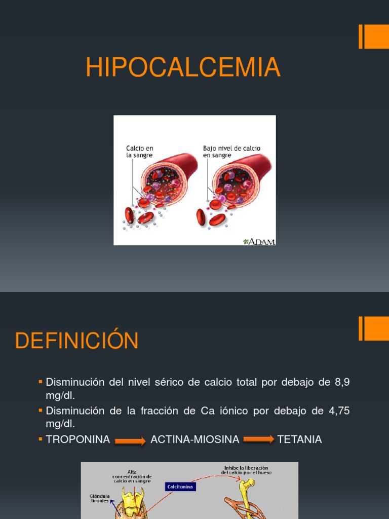 HIPOCALCEMIA diapositivas | Medicina CLINICA | Enfermedades y trastornos