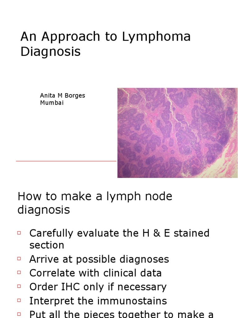 Lymphoma Diagnosis and Evaluation Guide | PDF | Lymphoma | Lymphatic System