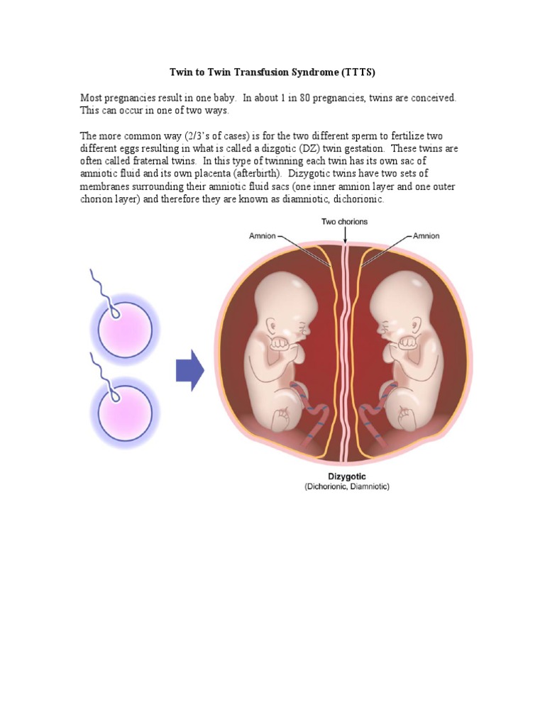 Twin To Twin Transfusion Syndrome (TTTS) | PDF | Twin | Human Pregnancy