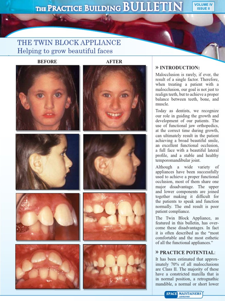 Twin Block | PDF | Snoring | Sleep Apnea