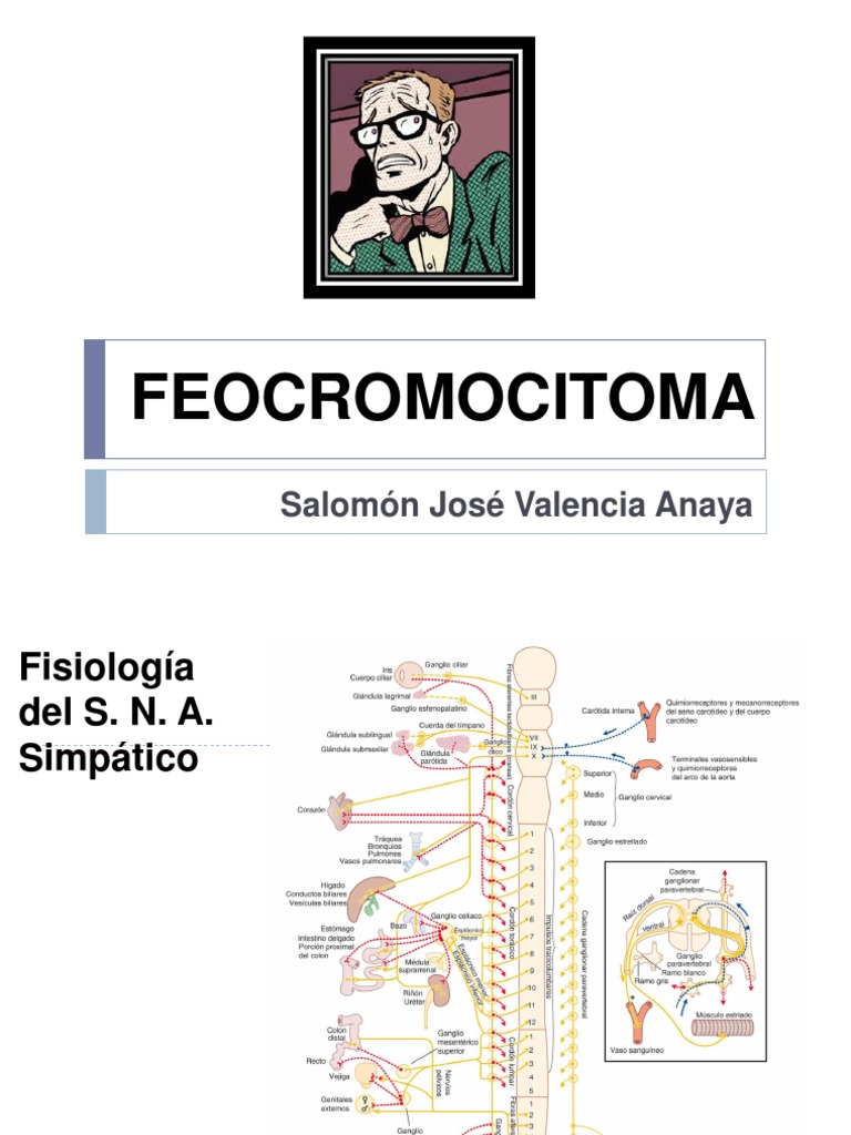 Feocromocitoma 1 | PDF | Glándula suprarrenal | Epinefrina