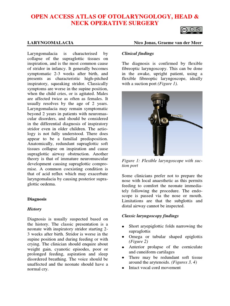Supraglottoplasty for laryngomalacia.pdf | Surgery | Anesthesia | Free ...