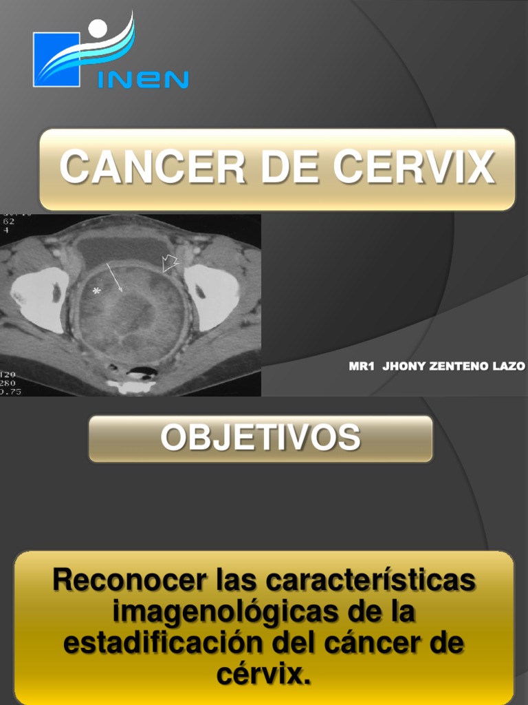 Estadificación del Cáncer de Cérvix | PDF | Cáncer de cuello uterino ...