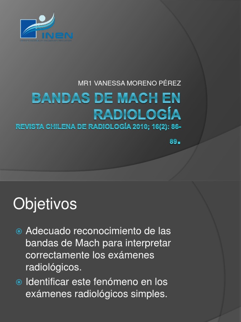 Bandas de Mach en Radiología | PDF