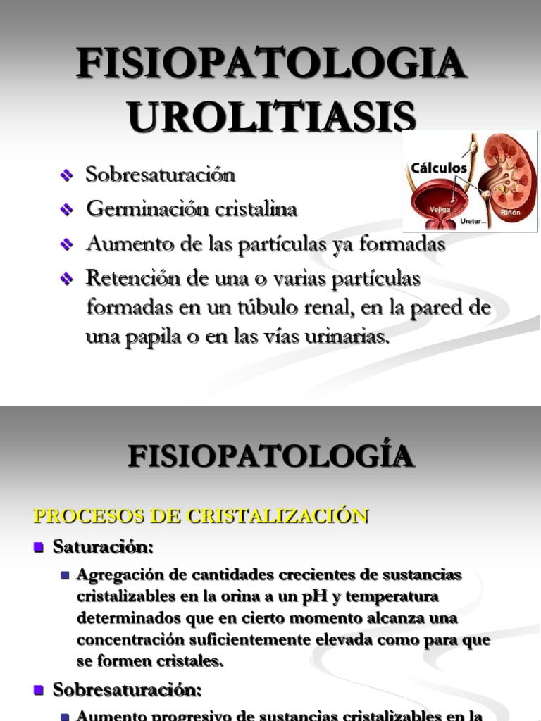 urolitiasis-fisiopat | Cristalización | Orina