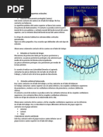 Ángulo de Bennett | PDF