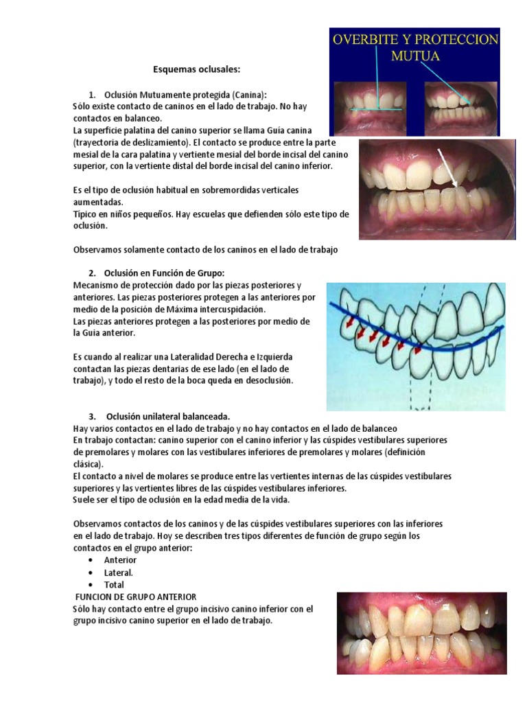 Esquemas Oclusales Trabajo | Boca | Ramas de odontología