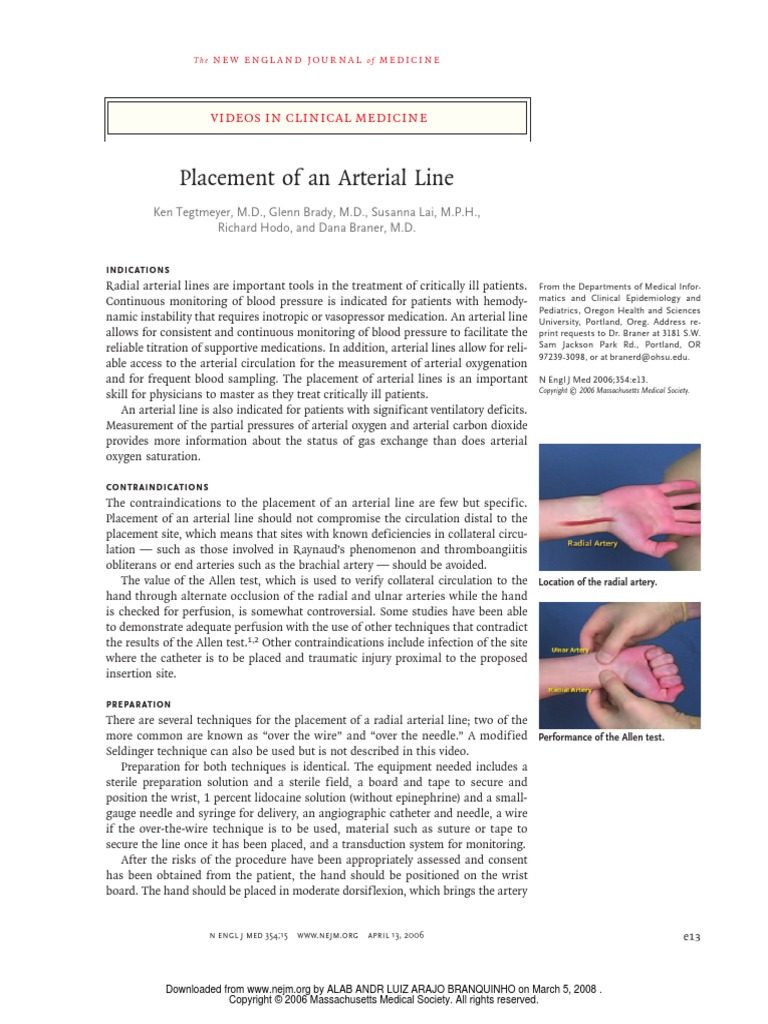 Placement of An Arterial Line | PDF