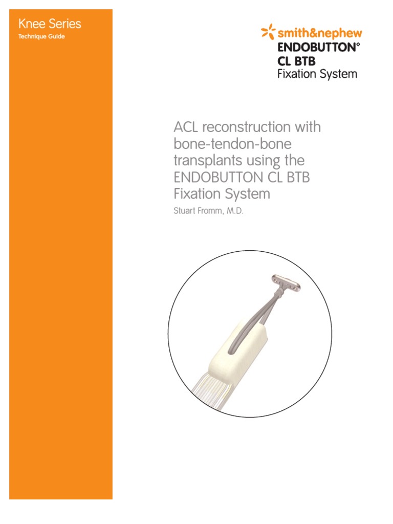 ACL Reconstruction With Bone-Tendon-Bone Transplants Using The ...