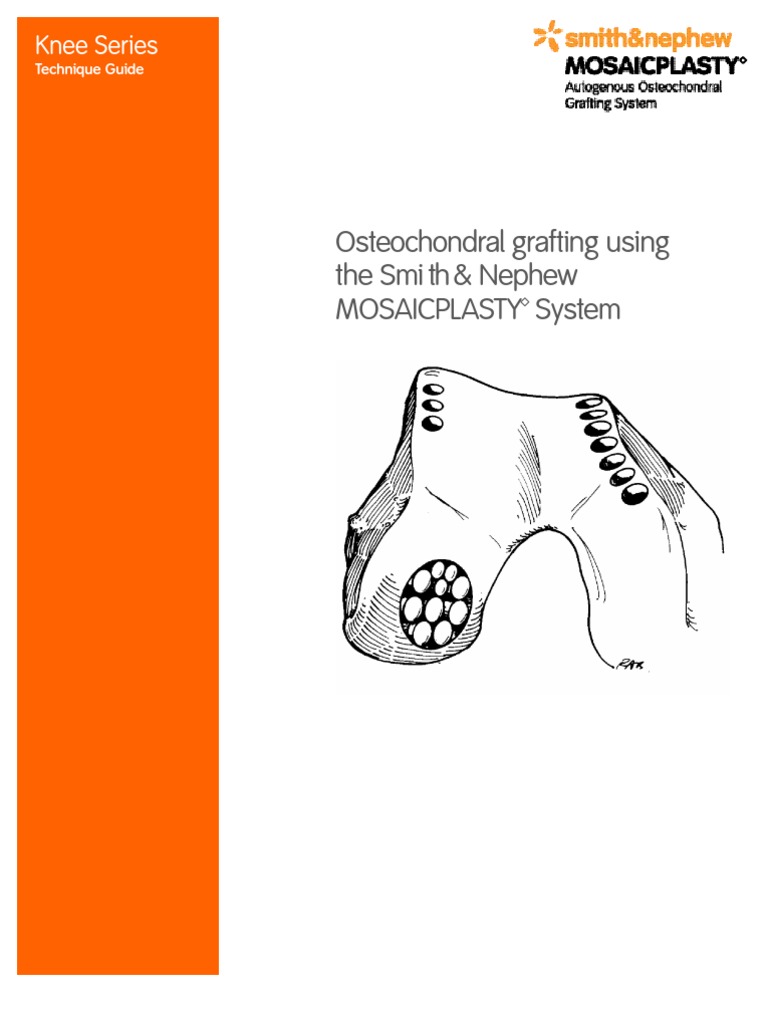 mosaicplasty | Knee | Orthopedic Surgery