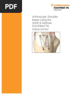 Fiberstitch All Inside Meniscal Repair | PDF | Surgical Suture ...