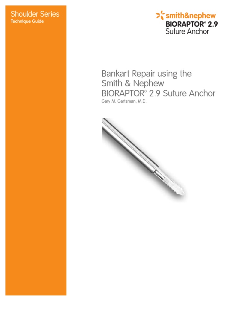 Bankart Repair Using The Smith & Nephew BIORAPTOR™ 2.9 Suture Anchor ...