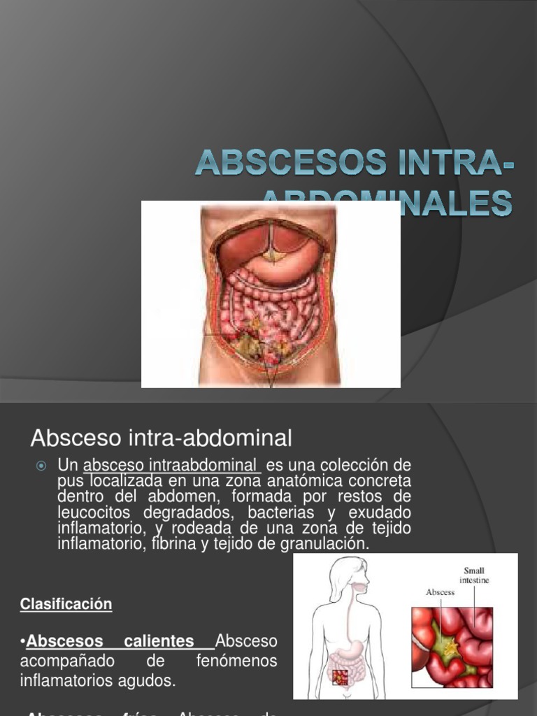 Abscesos Intra Abdominales