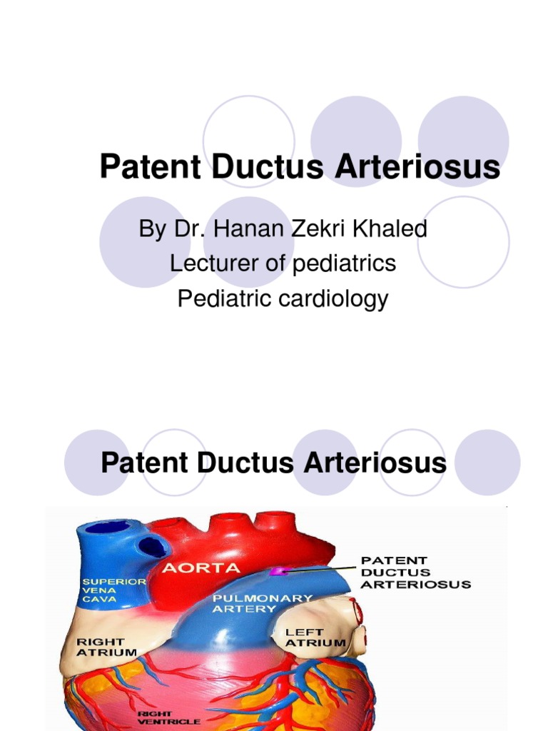 Patent Ductus Arteriosus Fetus Cardiovascular System