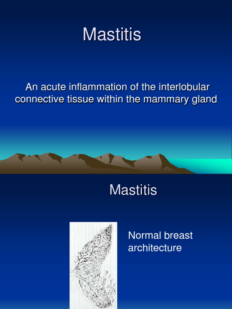 Mastitis | PDF | Medical Specialties | Diseases And Disorders