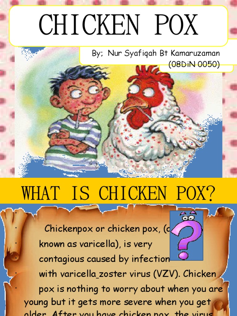 Chicken Pox Presentation | PDF | Animal Virology | Virology