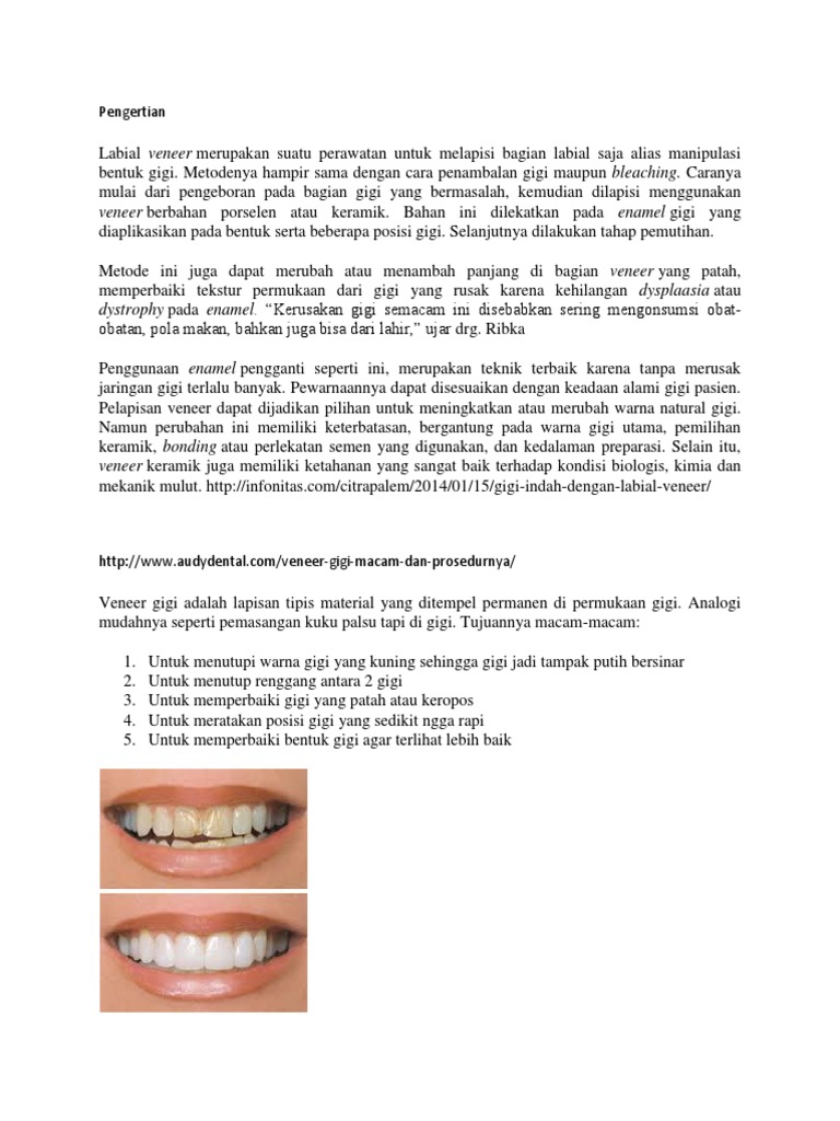 Venner Pengertian | PDF