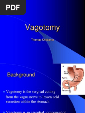 Types Of Vagotomy