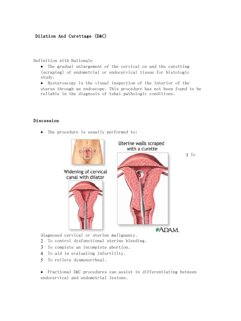 DNC 2 | Gynaecology | Women's Health