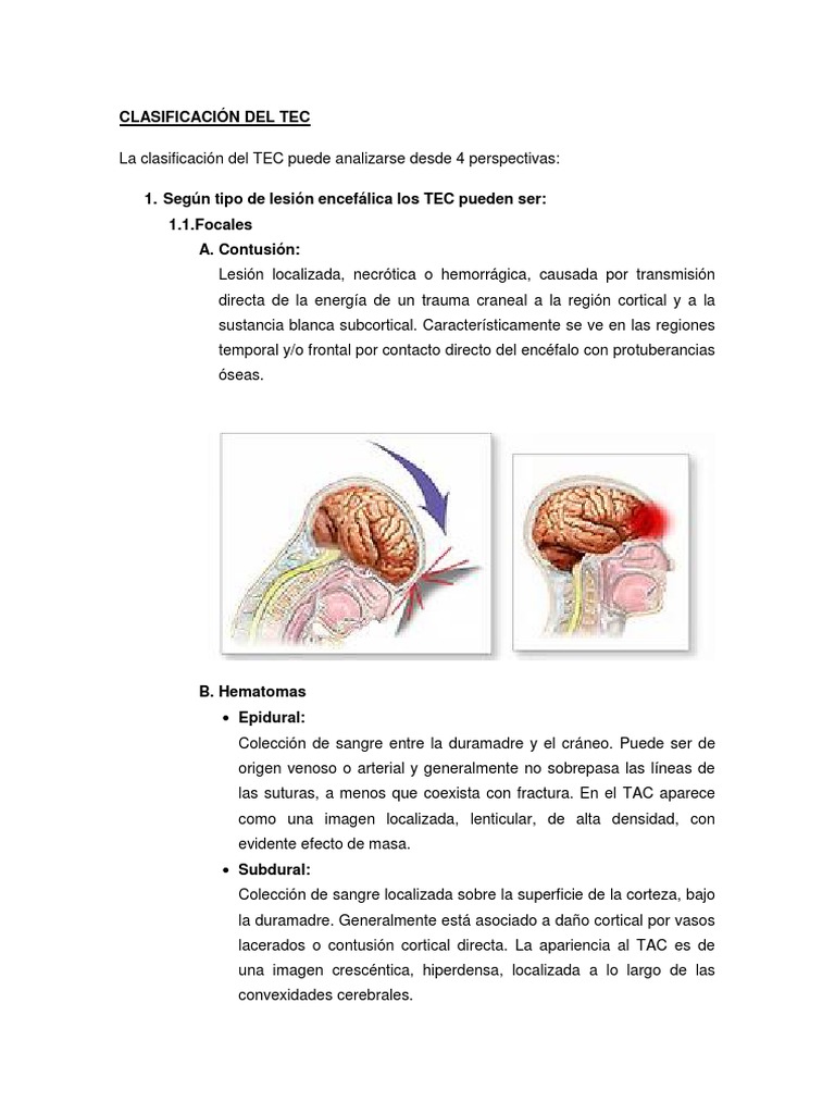 Clasificación Del Tec | PDF | Lesión | Edema