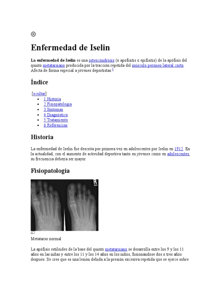 Enfermedad de Iselin | PDF