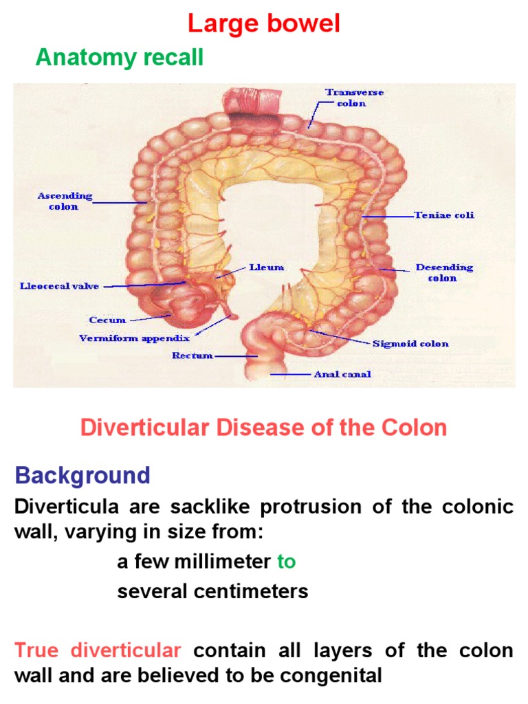 Diverticular Disease of the Colon | Bleeding | Large Intestine