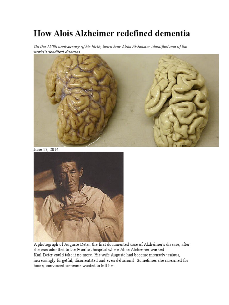 How Alois Alzheimer Redefined Dementia | PDF | Dementia | Alzheimer's ...