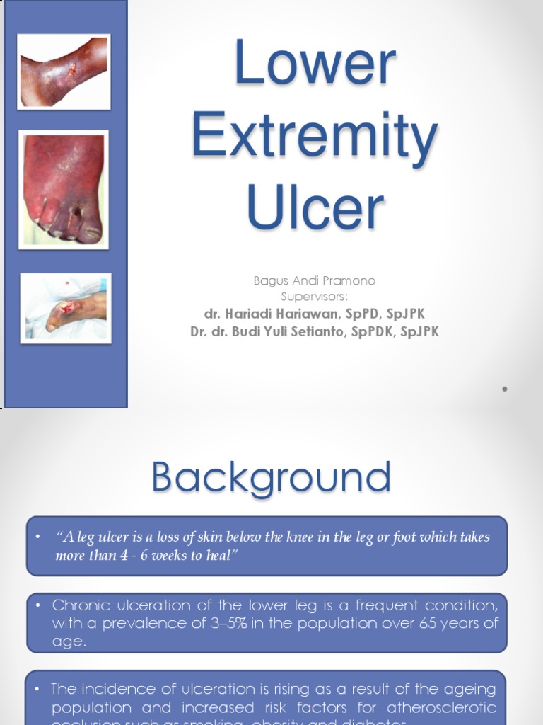 Lower Extremity Ulcer | Wound | Vein