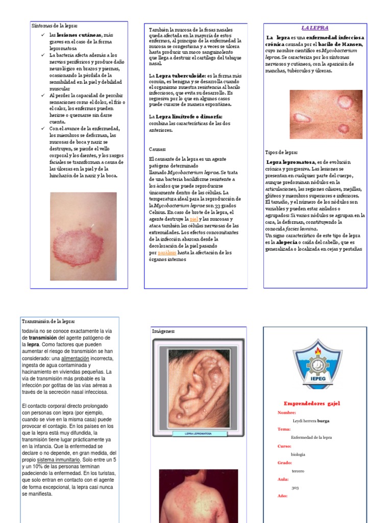 1 | PDF | Lepra | Infección