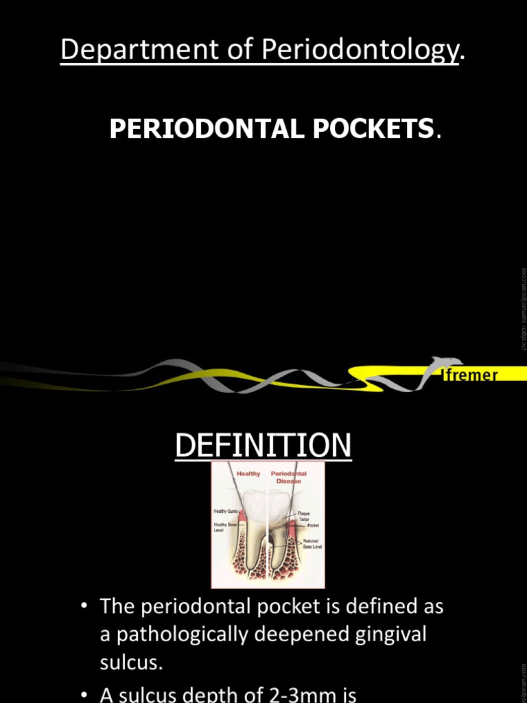 Periodontal Pocket Pathogenesis | PDF | Inflammation | Epithelium