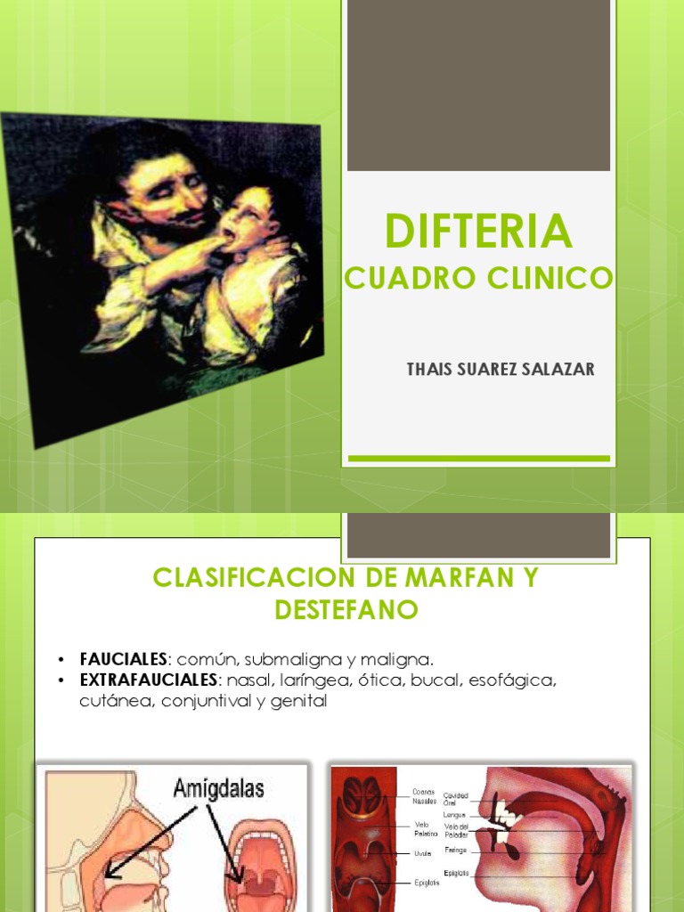 Clasificación y síntomas de la difteria | PDF