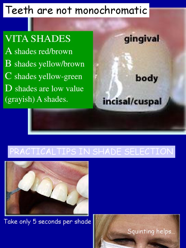 Class IV Restorations | PDF | Dental Composite | Dentistry Branches