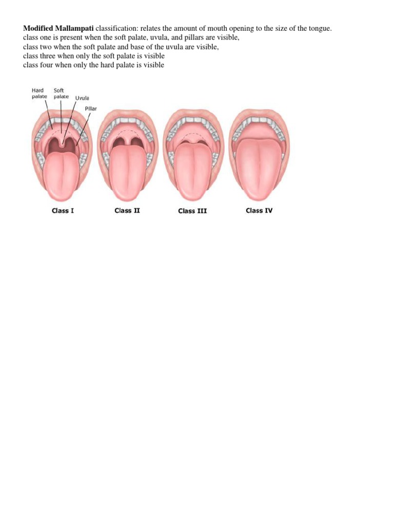 Modified Mallampati Classification | PDF | Language Arts & Discipline ...