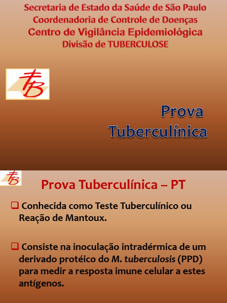 Guia sobre a Prova Tuberculínica: técnica de aplicação, interpretação ...
