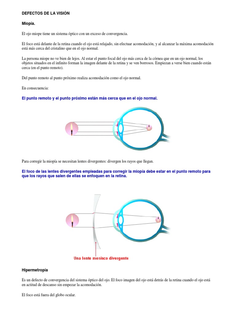 Defectos Del Ojo | PDF | Ojo humano | Percepción visual