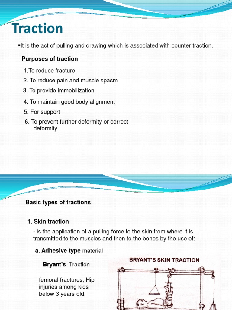Traction | Hip | Scoliosis