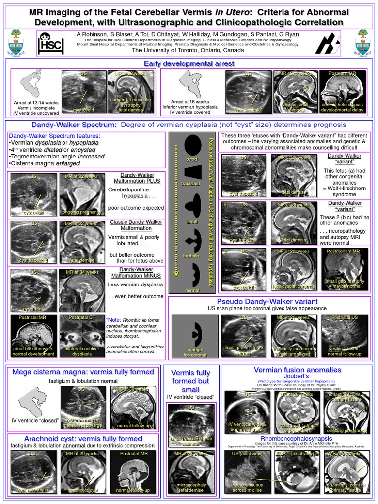 Abnormal Vermis | PDF | Congenital Disorder | Clinical Medicine