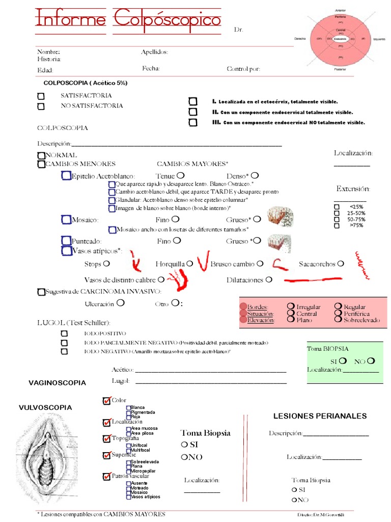 Modelo Informe Colposcópico | PDF | Estudios de idiomas extranjeros ...