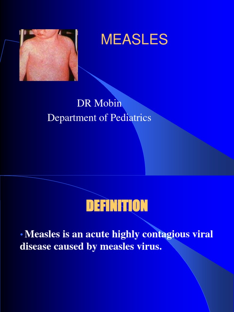 MEASLES Presentation.ppt | Measles | Infection