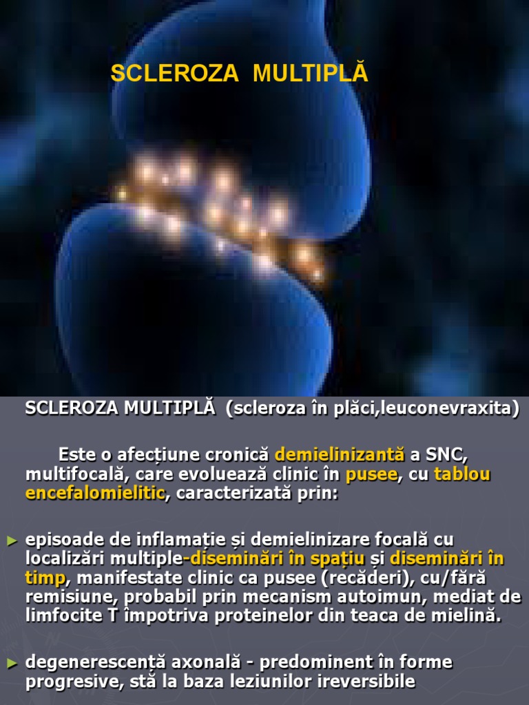 Scleroza Multipla | PDF