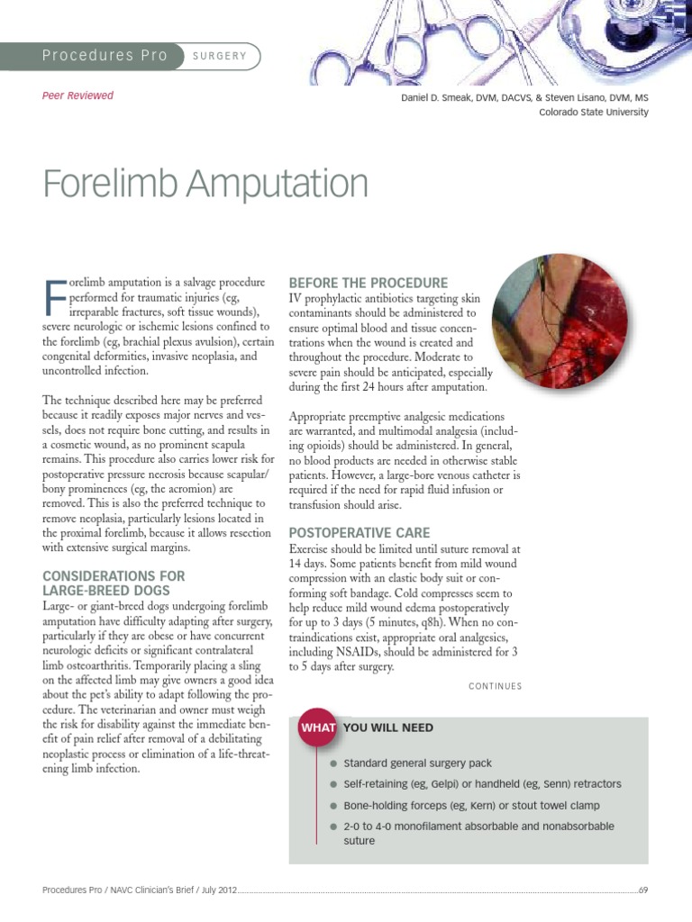 Step by Step Amputation | PDF | Amputation | Surgery