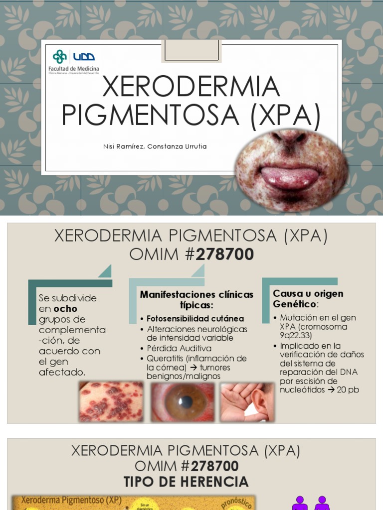 Xerodermia Pigmentosa (Xpa) | PDF | Adn | Cáncer