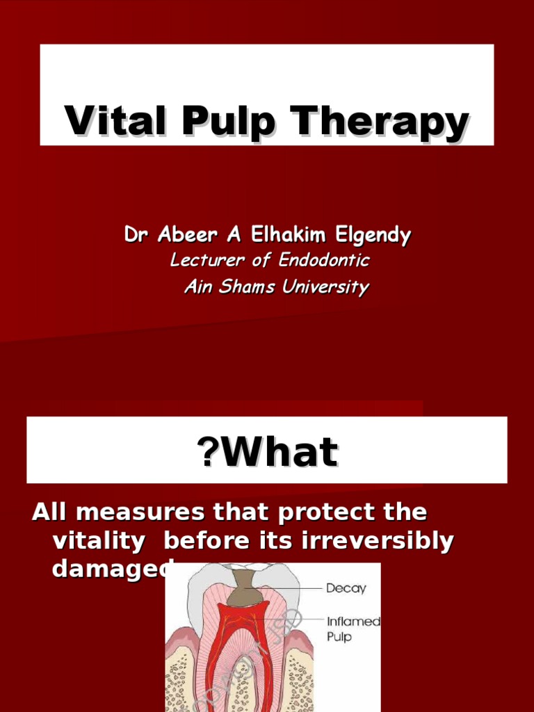 Vital Pulp Therapy | PDF | Human Tooth | Mouth