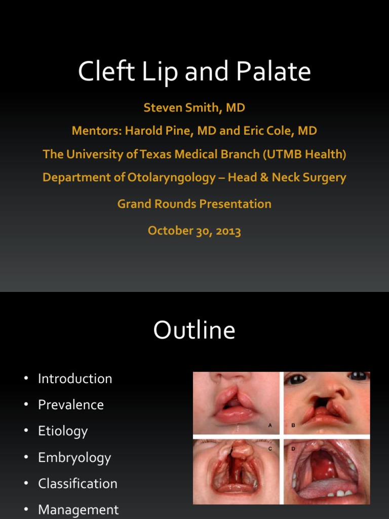 Cleft Lip Palate Pic 2013 10 | PDF