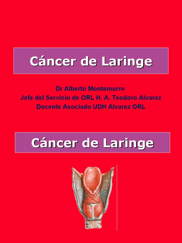 Cáncer De Laringe 1 Pdf Laringe Cáncer